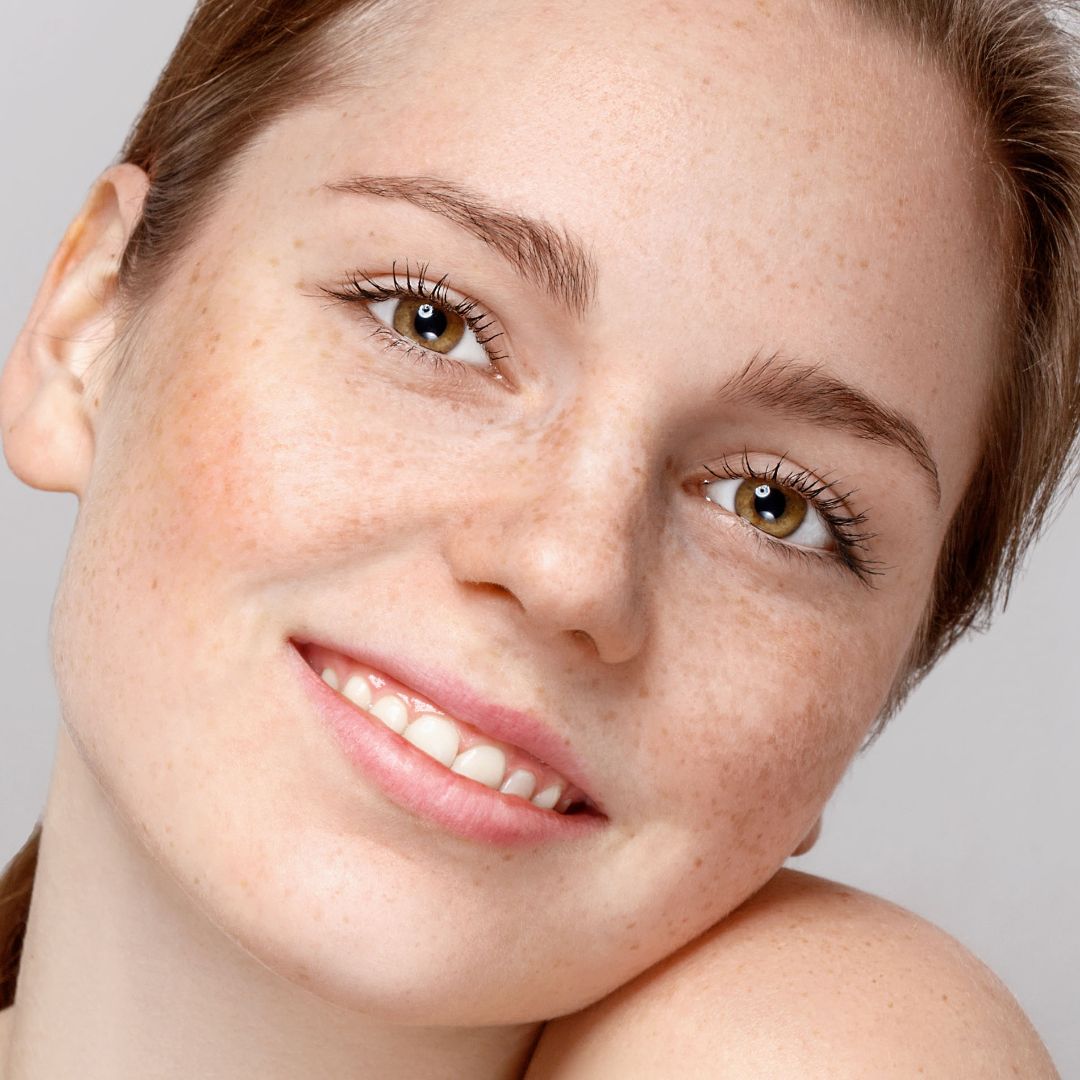 Complexion correction for imperfect skin!