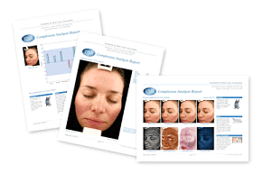 VISIA Comprehensive Complexion Plano TX - Facial Analysis