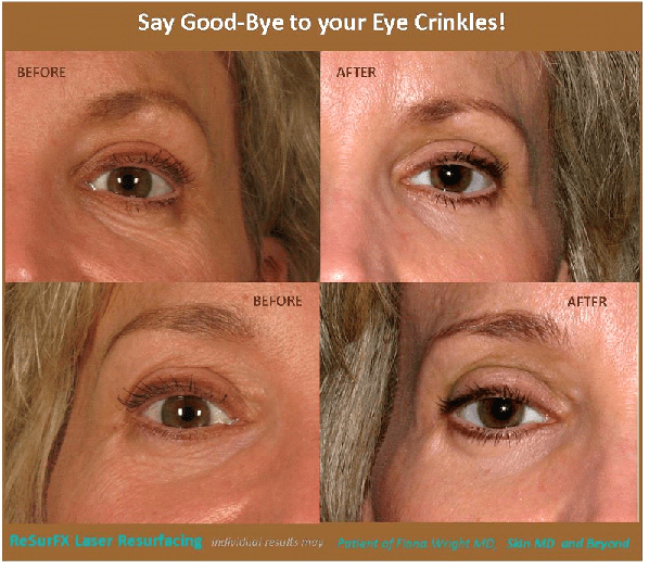 Eyes - Cosmetic Skin Care Specialist Plano, TX