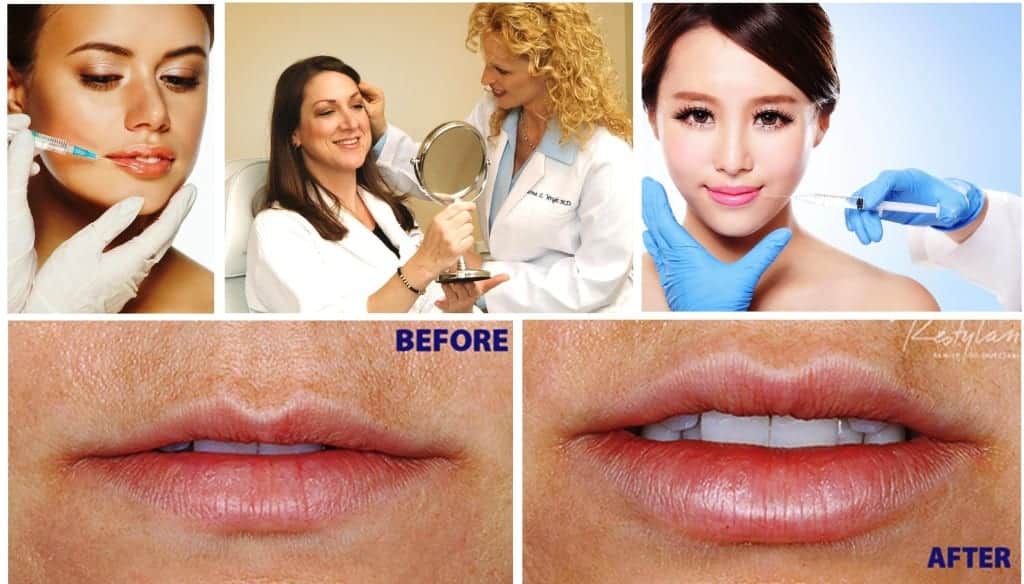 Beautifully Defined and SILKY Full Lips | Skin MD and Beyond