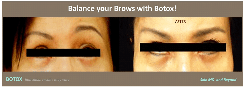 Brows - Cosmetic Skin Care Specialist Plano, TX