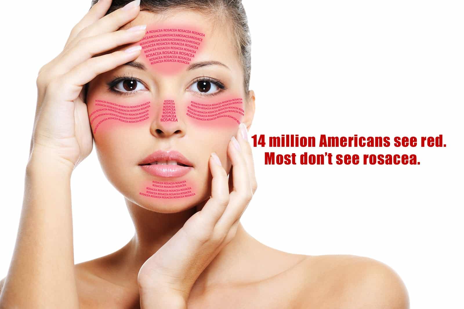 Are You Seeing Red?? - Cosmetic Skin Care Specialist Plano, TX